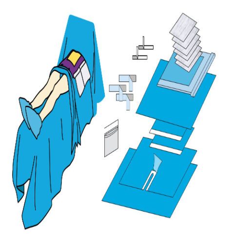 NMN 2022-2956 Cardiovascular Drape Pack | Clonallon